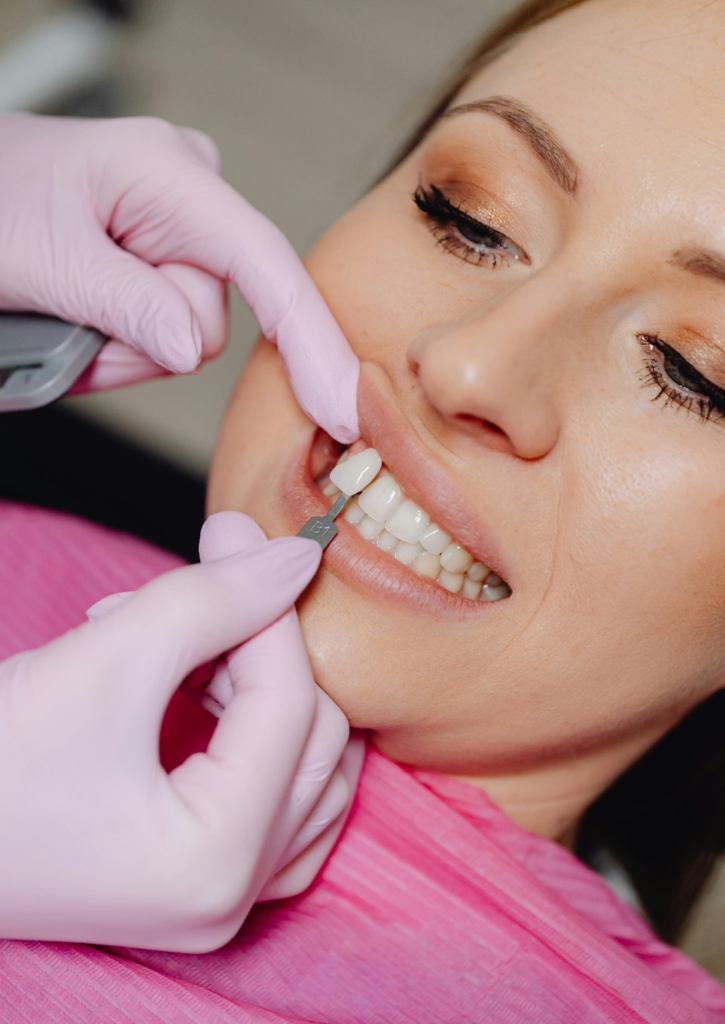 What to Expect During Your Dental Veneer Procedure? - Advanced Dental Germantown